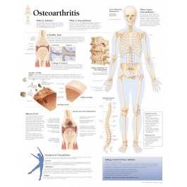 Scientific Publishing Osteoarthritis Education Chart