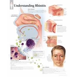 Scientific Publishing Understanding Rhinitis Anatomy Chart