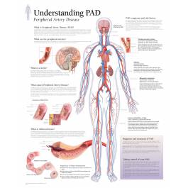 Scientific Publishing Understanding Peripheral Artery Disease Chart