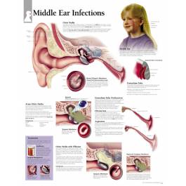 Scientific Publishing Middle Ear Infections Chart