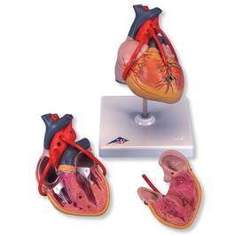 3B Scientific G05 Heart Model with Bypass 2-Part