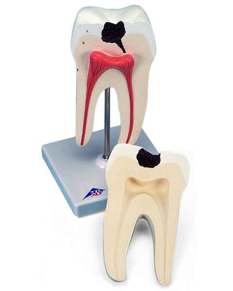 Dental Anatomy Models Tooth | Jaw Anatomical Models