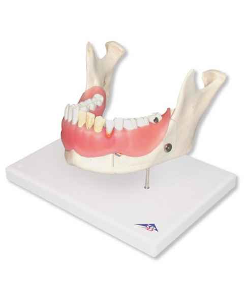Dental Anatomy Models Tooth | Jaw Anatomical Models