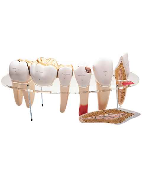 Dental Anatomy Models Tooth | Jaw Anatomical Models