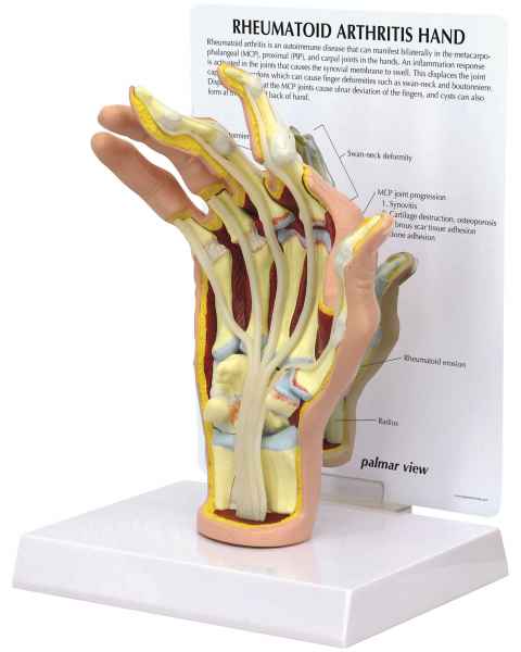 Hand Anatomy Models | Hand Anatomical Models