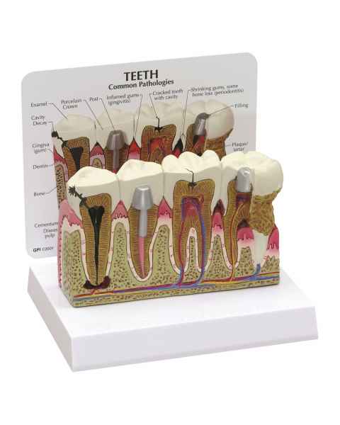 Page 2 | Dental Anatomy Models Tooth | Jaw Anatomical Models