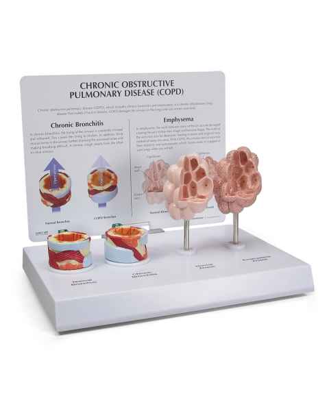 Respiratory Anatomy Models | Lung Anatomical Models