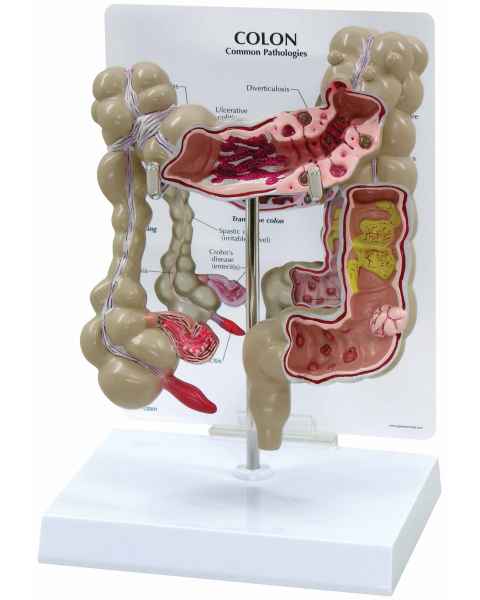Human Urinary Models Urinary | System Anatomical Models