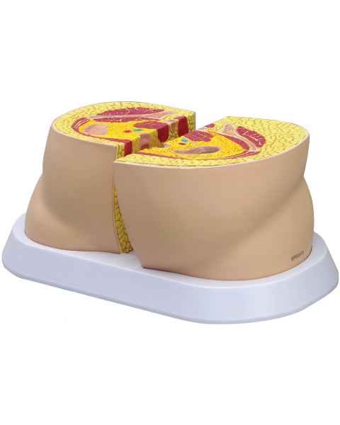 Exercise & Diet Education Anatomy Models