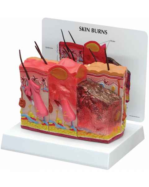 Skin Anatomical Models | Dermatology Education Models