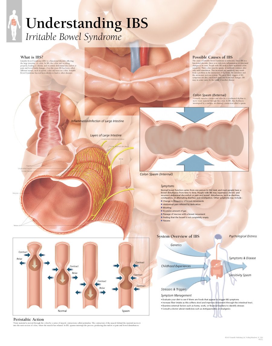 Irritable Bowel Syndrome Stool What Are The Most Commonly Listed IBS