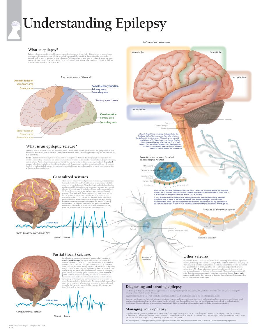 Epilepsy Brain Diagram Epilepsy Disease Symptoms, Causes, Types,