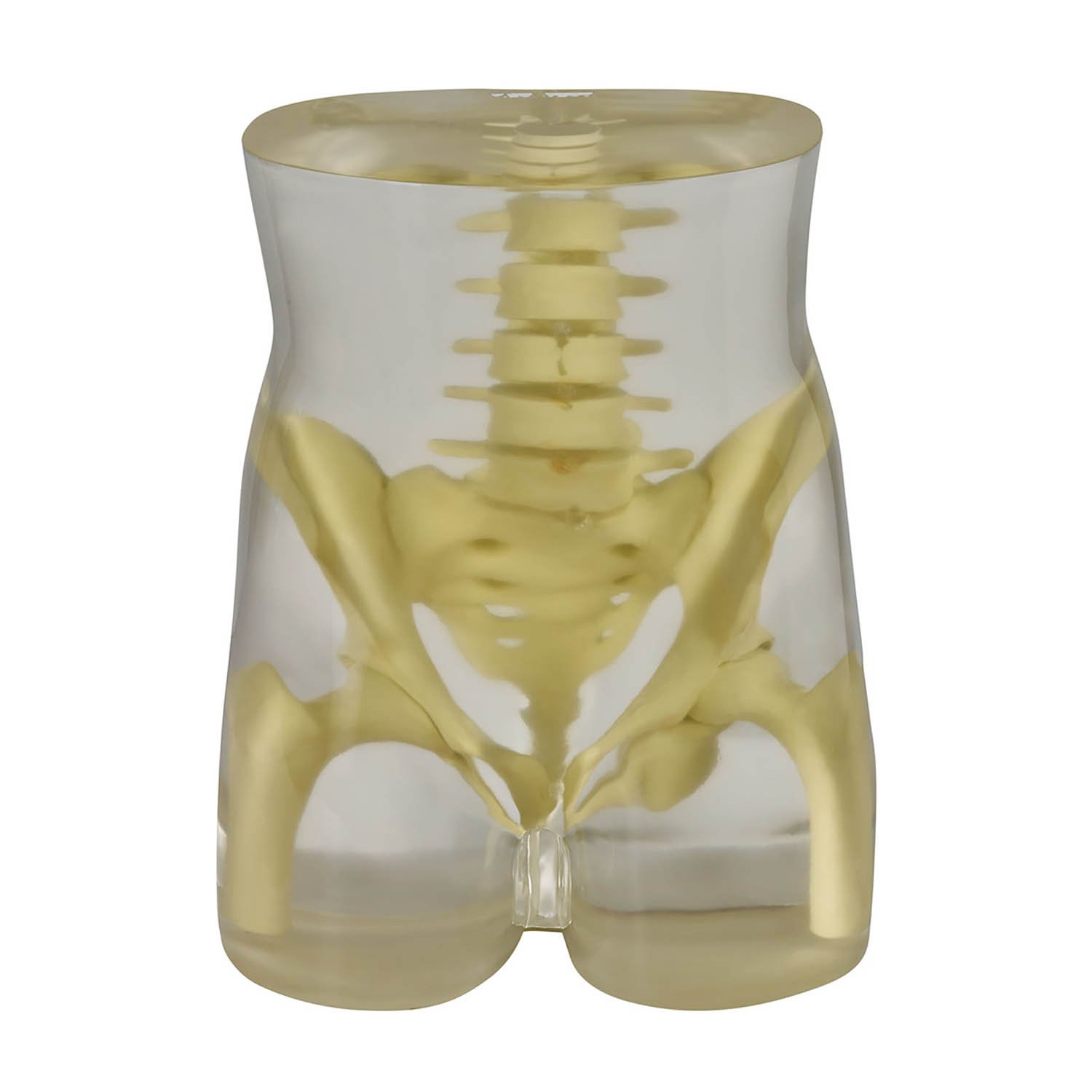 RSD Anthropomorphic Plevis Phantom