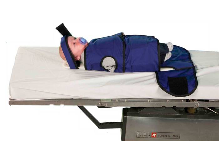 Papoose Board Radiolucent MRI Safe Papoose Board Restraint Small
