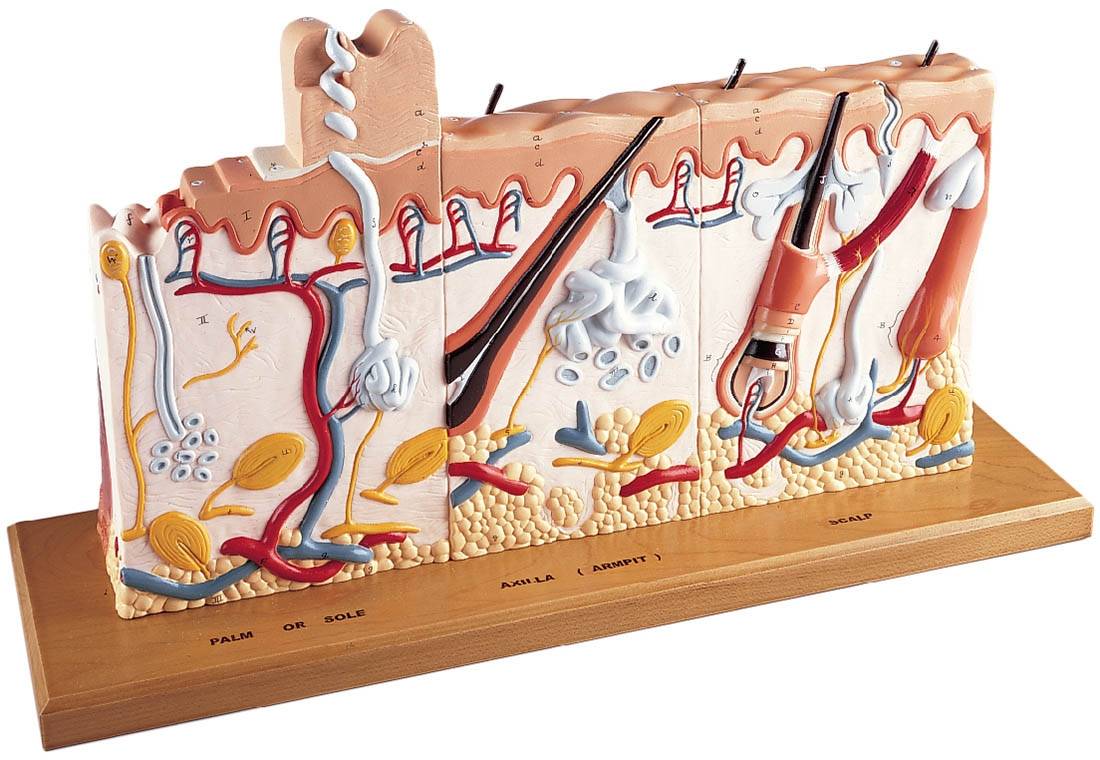 Denoyer Geppert Human Skin With Burn Pathologies Model