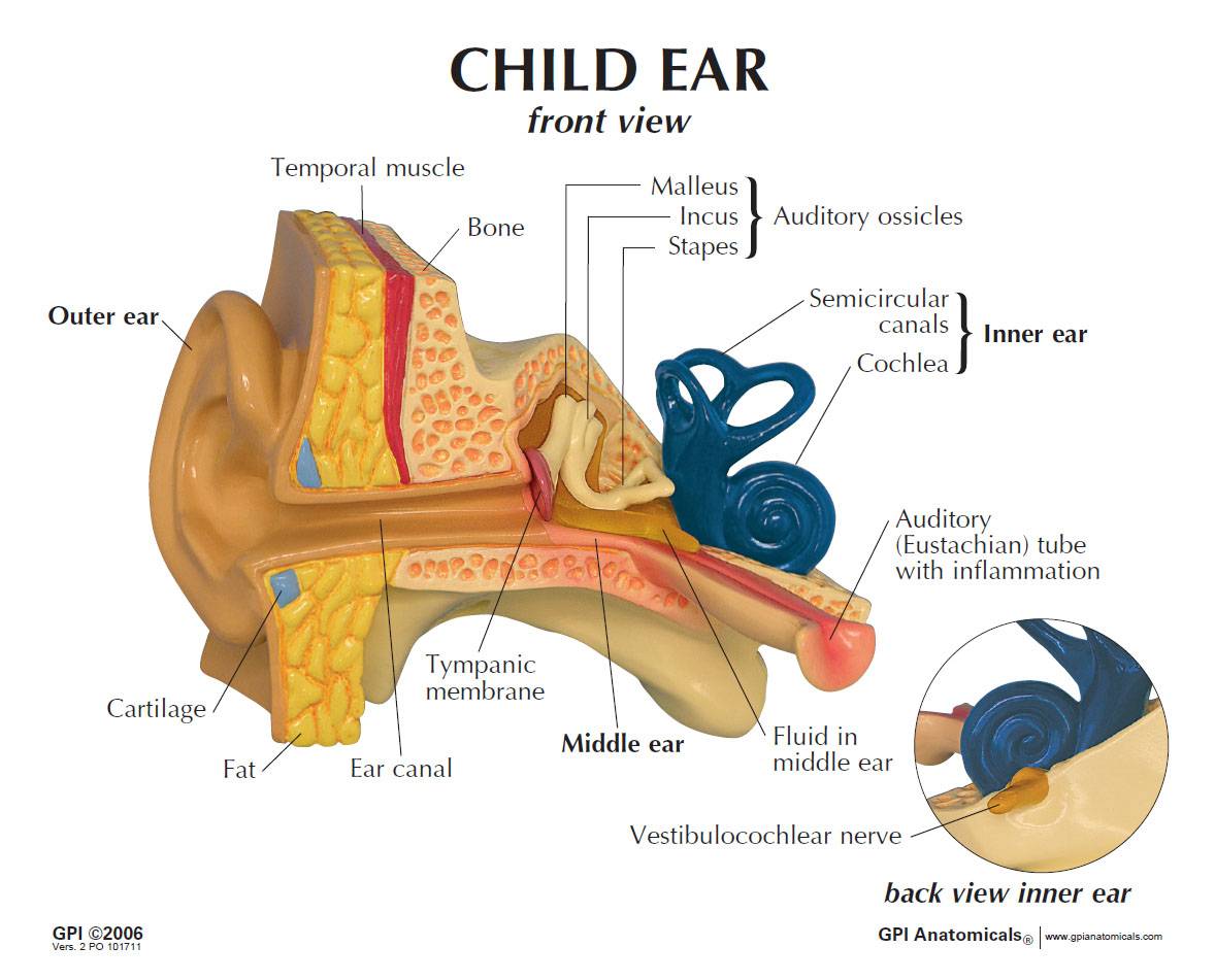 GPI 2300 Child's Ear with Otitis Media Model