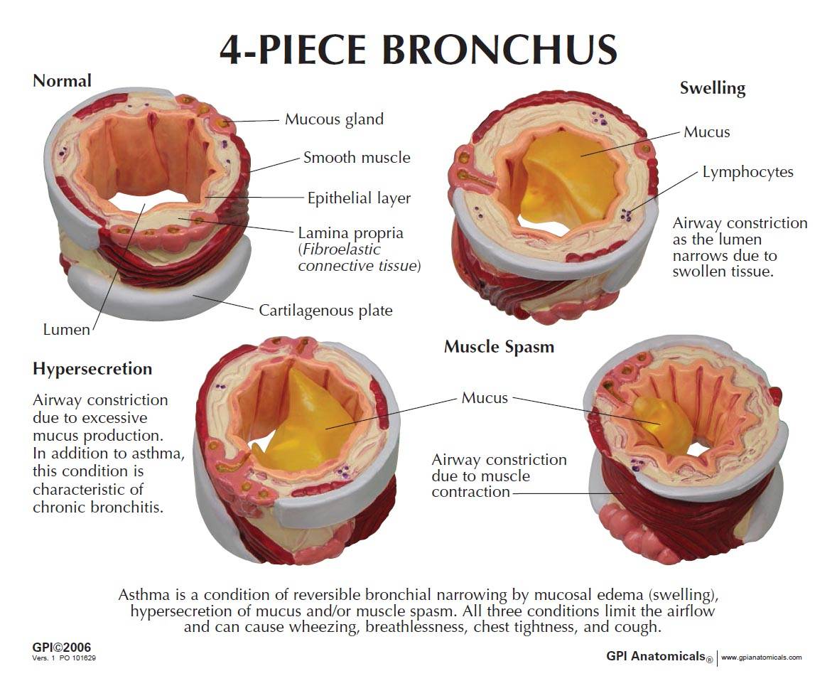 4 Piece Bronchus Section 4 Stage Gpi 3120