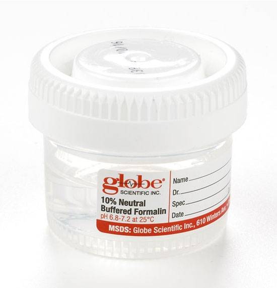 Tite-Rite Containers Prefilled with 10% Neutral Buffered Formalin Globe Scientific