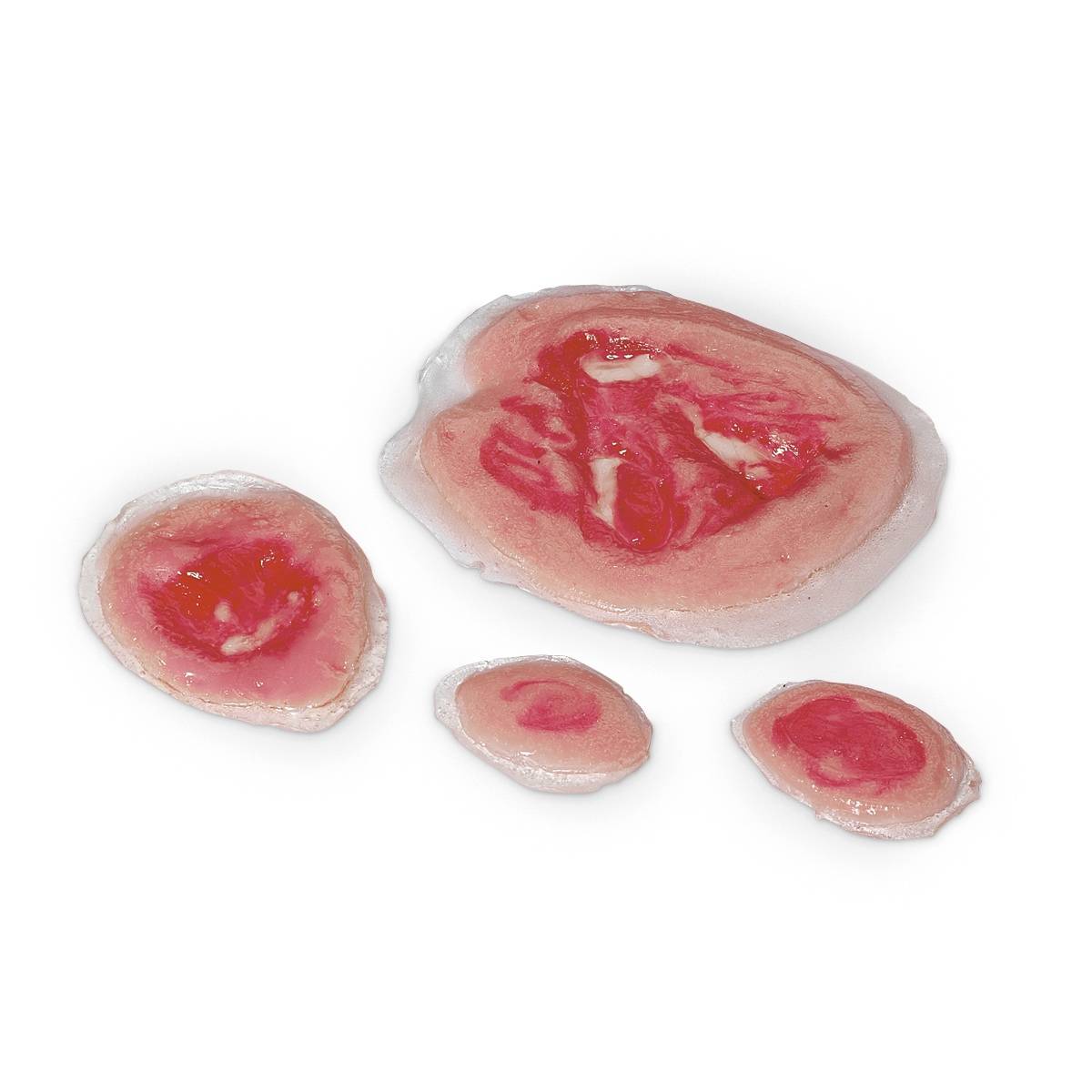 Life/form LF00730 Moulage Wound - Pressure Ulcers Simulator - Set of 4