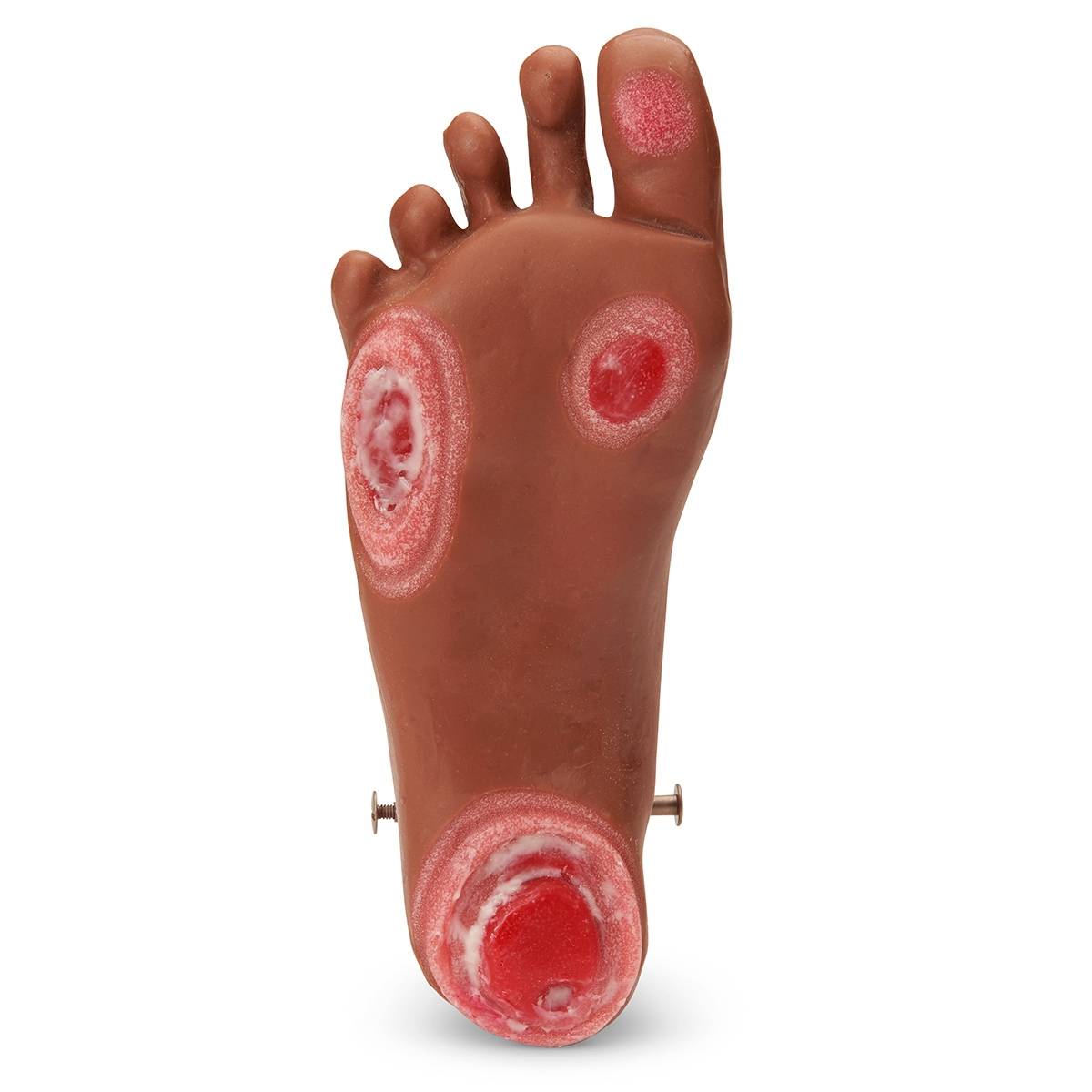 LF04128 Life/form GERi and KERi Optional Pressure Injury Foot - Medium
