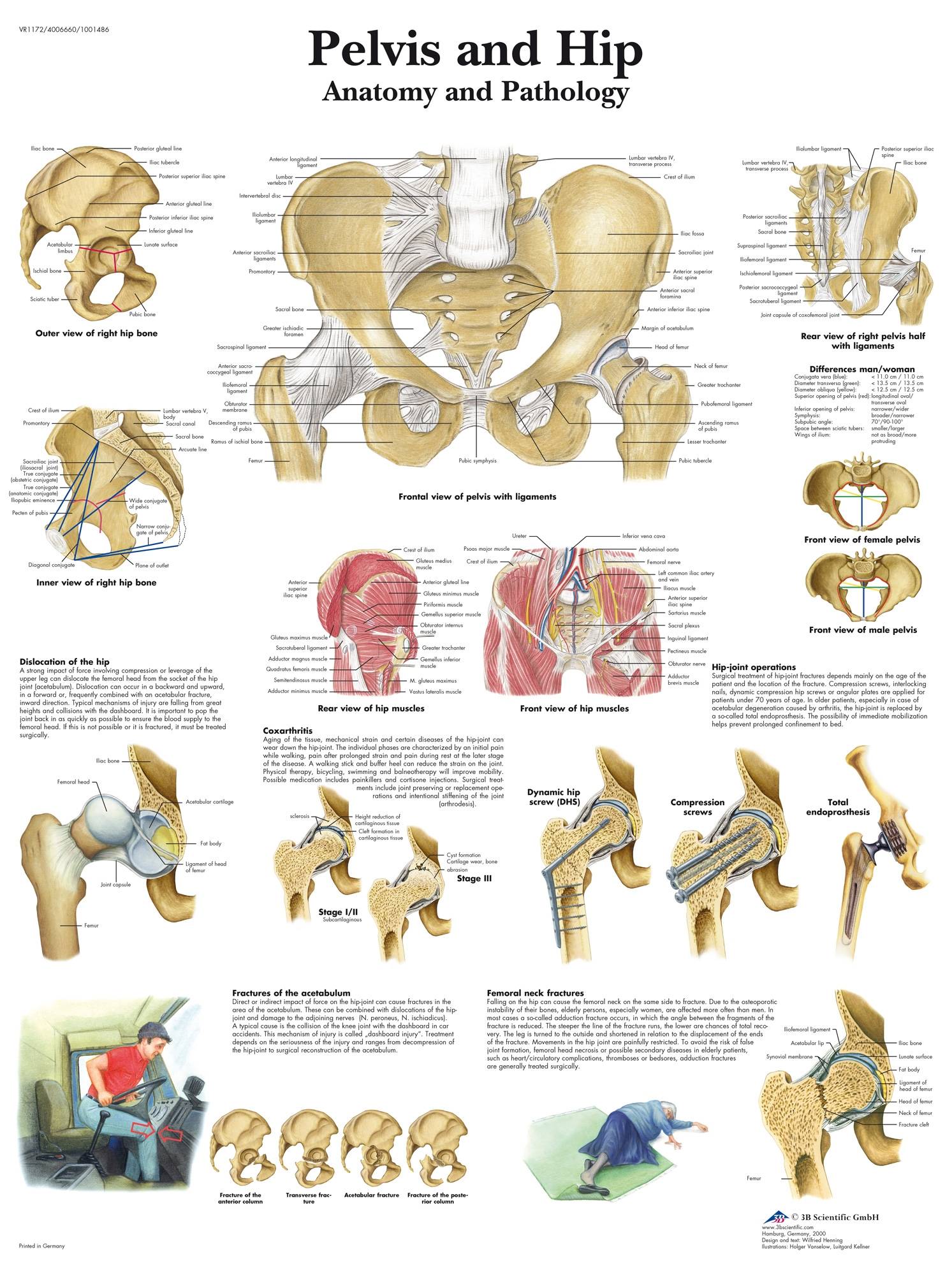 3B Scientific Pelvis an Hip Chart