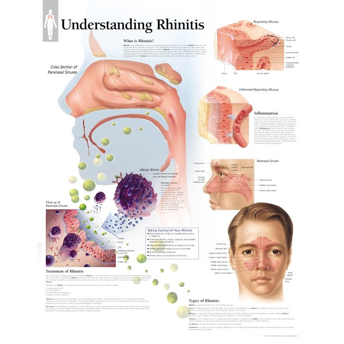 Scientific Publishing Understanding Rhinitis Anatomy Chart