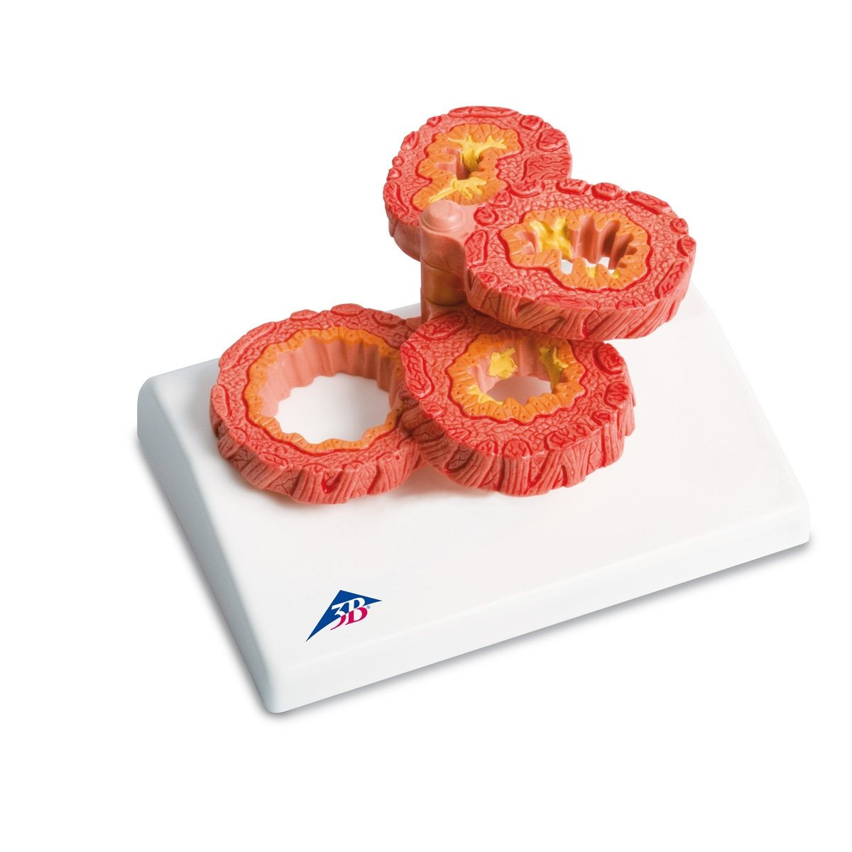 3B Scientific G50/1 COPD Model