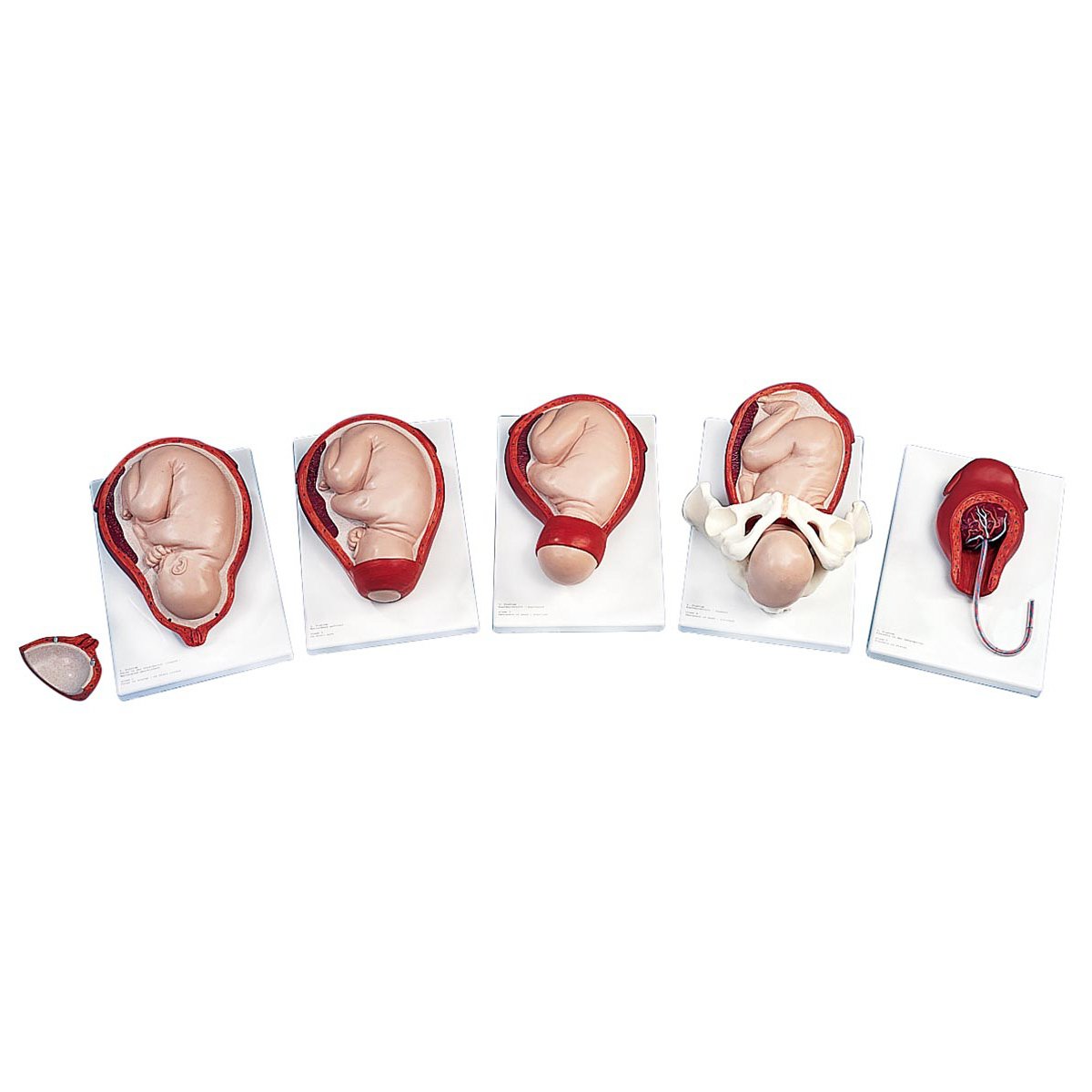 3B Scientific VG392 5-Stage Human Birth Process Model