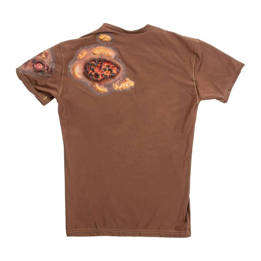 STOPS Medical Full Thickness Chest & Back Burn Sleeve Shirt