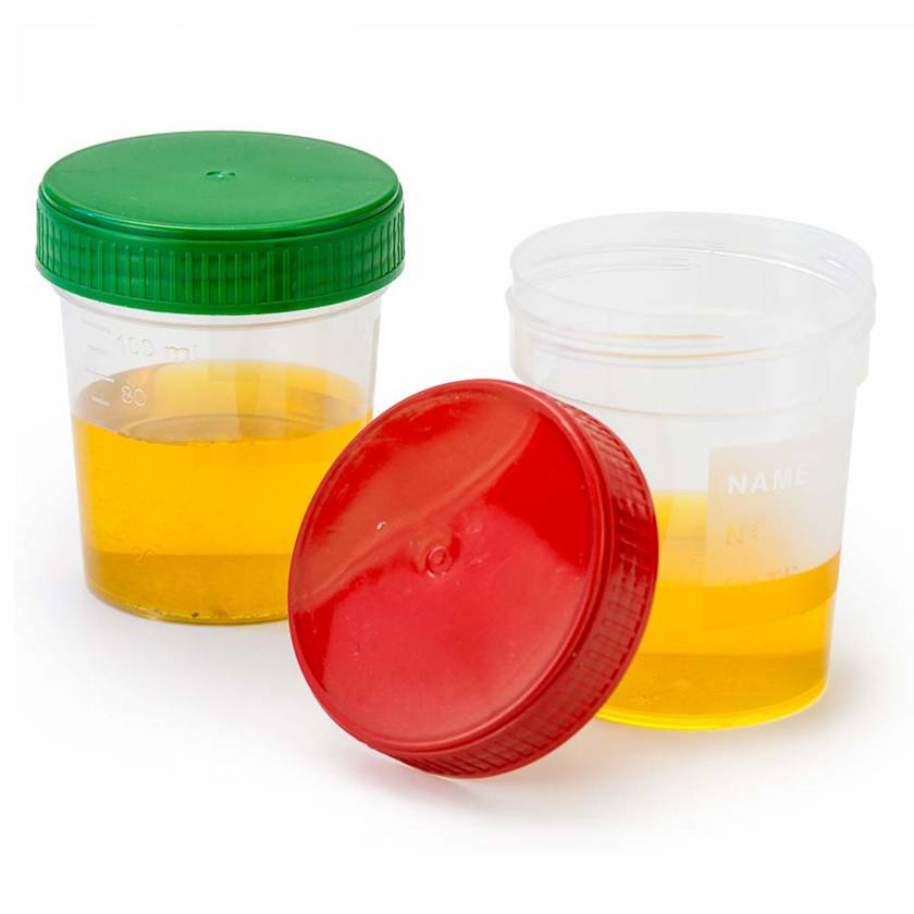 Globe Scientific Specimen Container with Full Turn Screw Cap