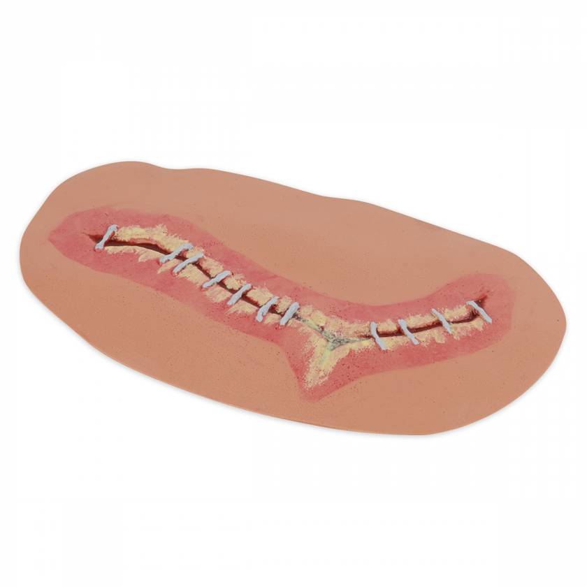 Life/form 800-658 Moulage Wound - Surgical Site Infection, Level 2 ...