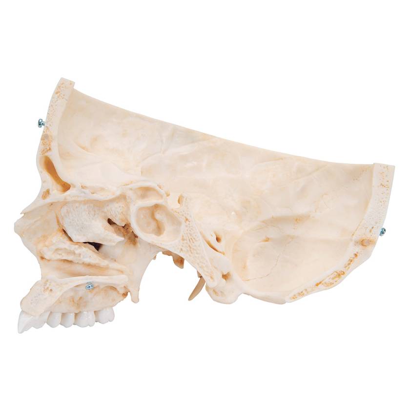 3B Scientific A281 6-Part Bonelike Human Skull Model