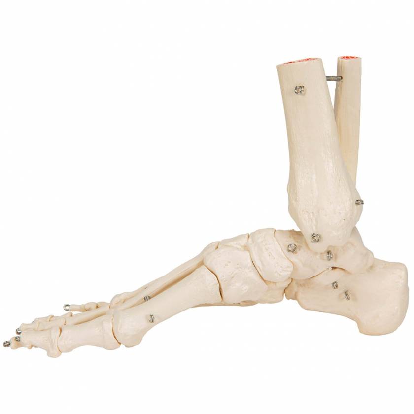 3B Scientific A31L Rigid Skeletal Foot Model Portion Tibia Fibula