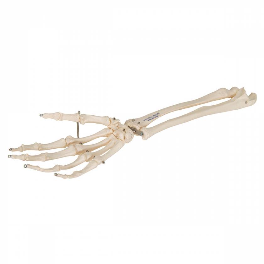 3B Scientific A41L Hand Skeleton Ulna Radius Portions Wire Mount