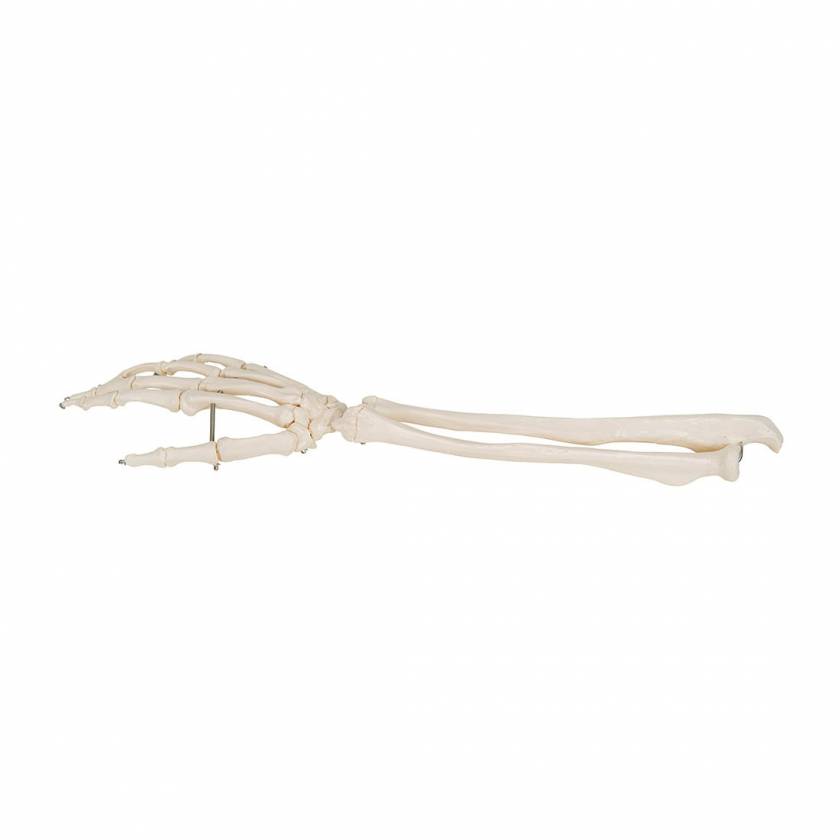 3B Scientific A41L Hand Skeleton Ulna Radius Portions Wire Mount