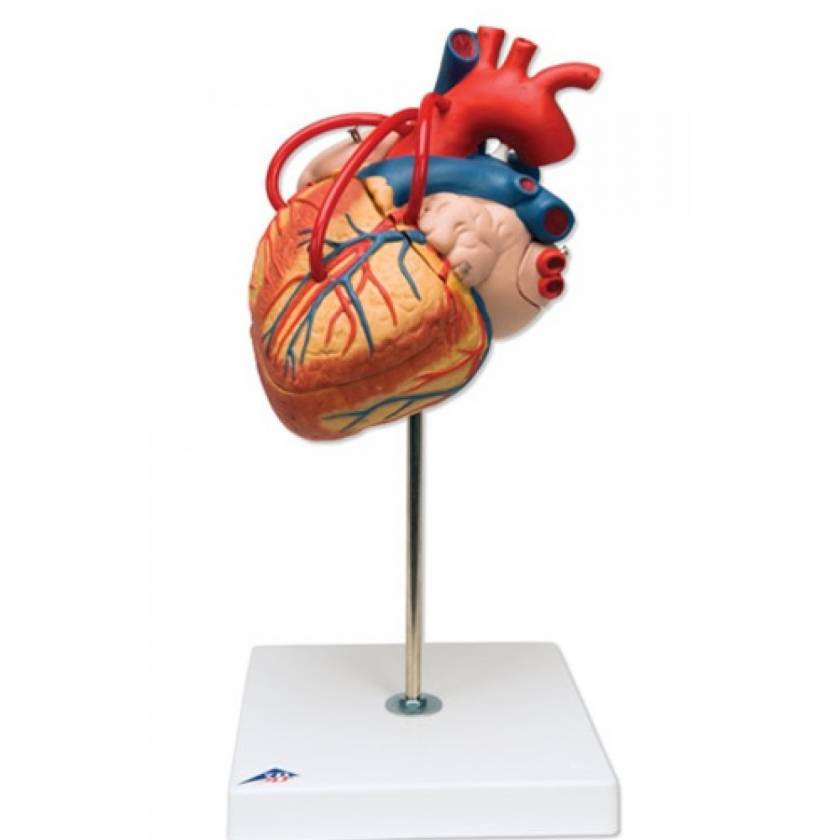 3B Scientific G06 Heart Model with Bypass 2 Times Life-Size 4-Part