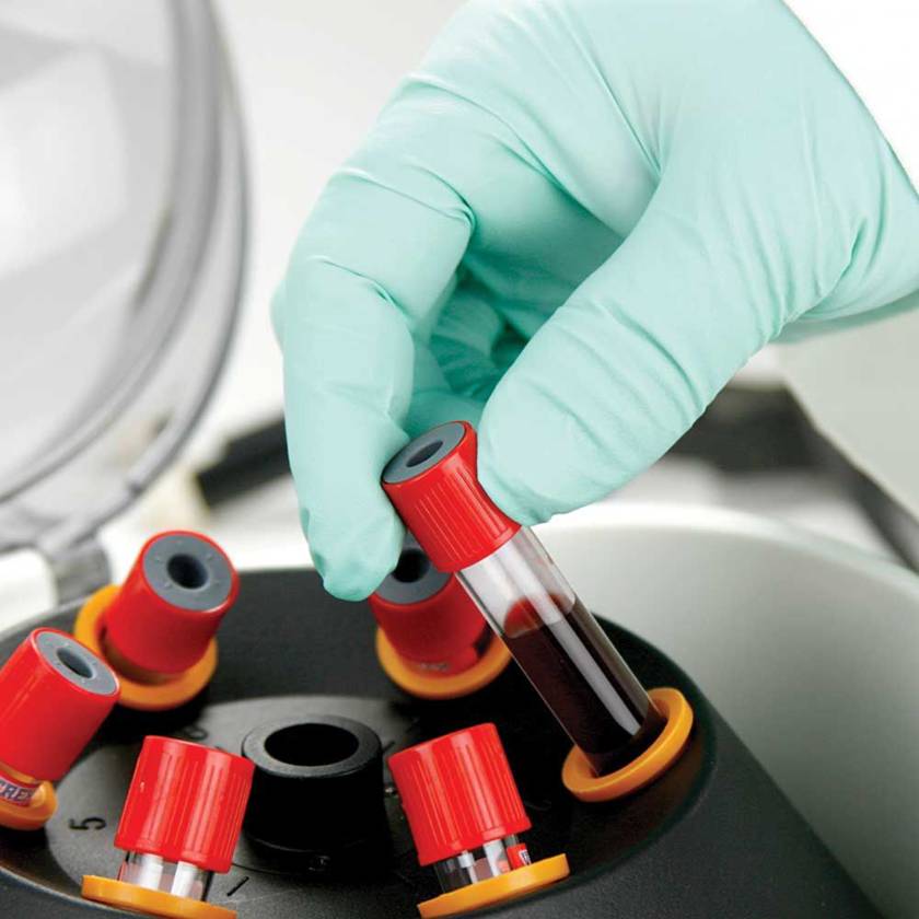 Globe Scientific GCC-P Portable Clinical Centrifuge