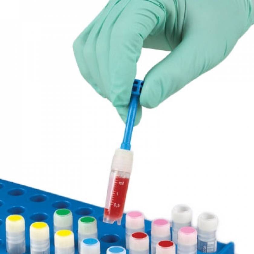 TPE Picker for CryoClear Cryogenic Vial Globe Scientific 30078