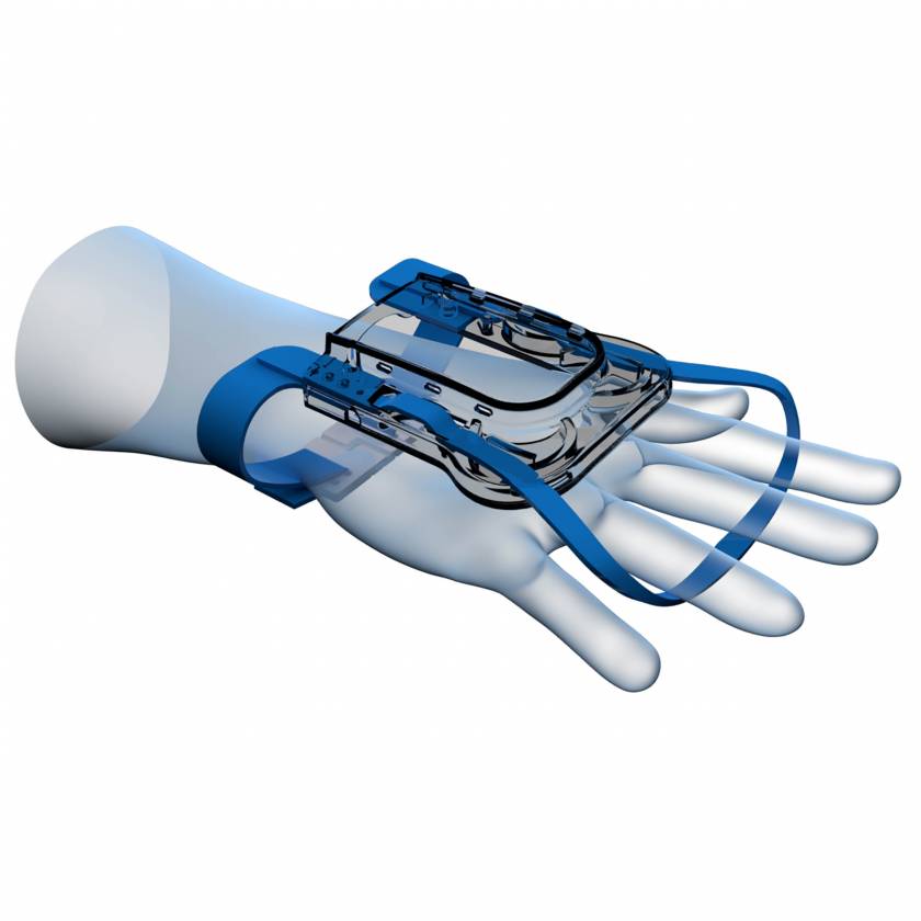 IV Glove 2.0 Adult Adhesive Free IV Securing System IVGA0002