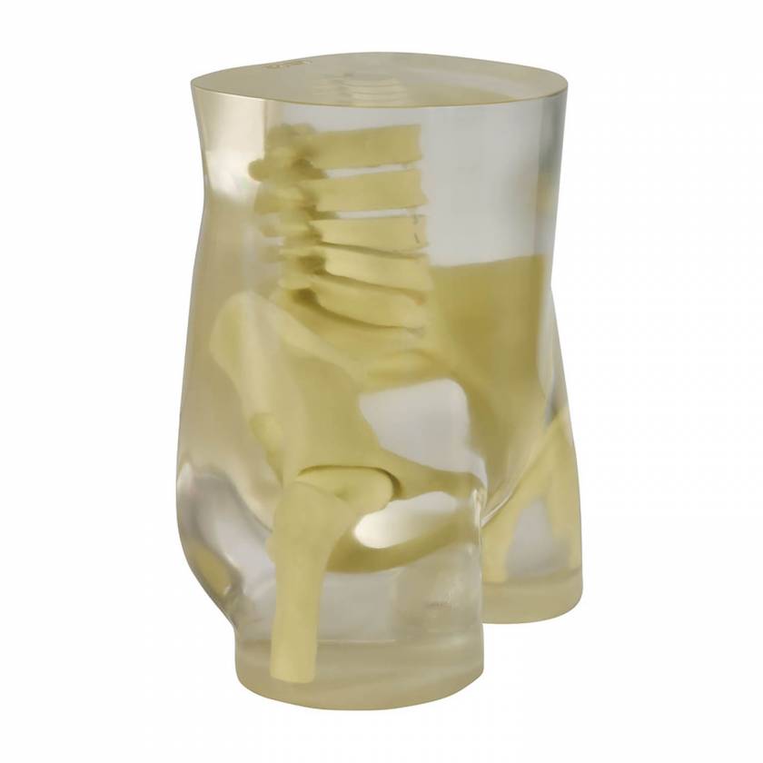 RSD Anthropomorphic Plevis Phantom