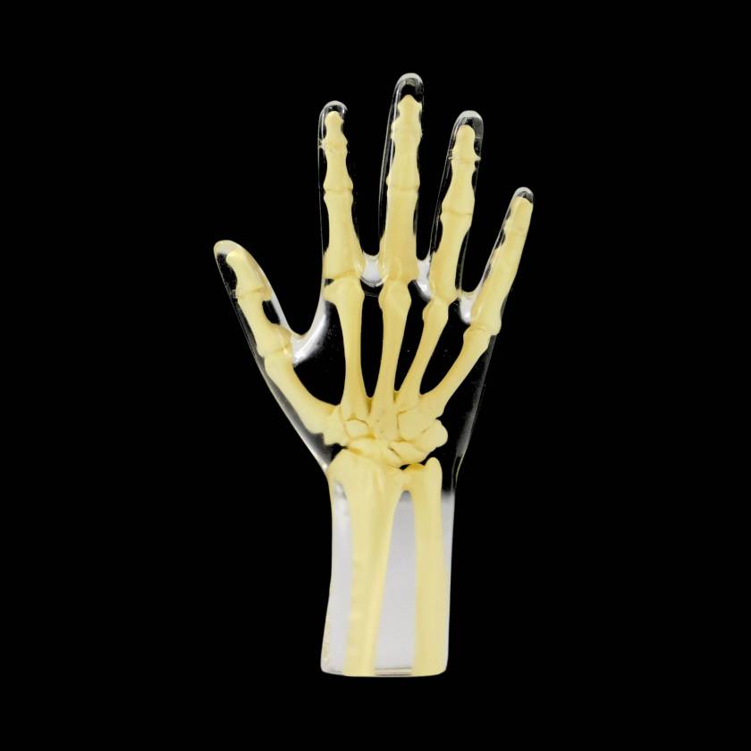 RSD Anthropomorphic Hand Wrist Phantom
