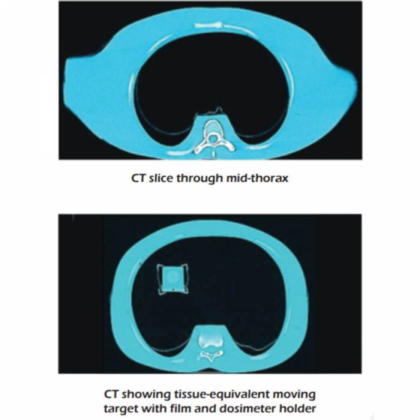 RSD RS-1500 Dynamic Breathing Phantom