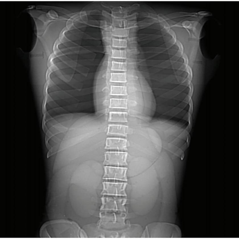 Take-Apart PIXY Phantom RS-103 RS-103T RS-104 RS-104T RS-105 RS-105T