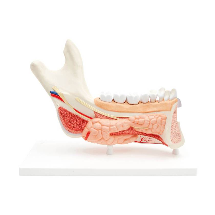 3B Scientific VE290 Advanced Half Lower Jaw 8 Diseased Teeth 19-Part