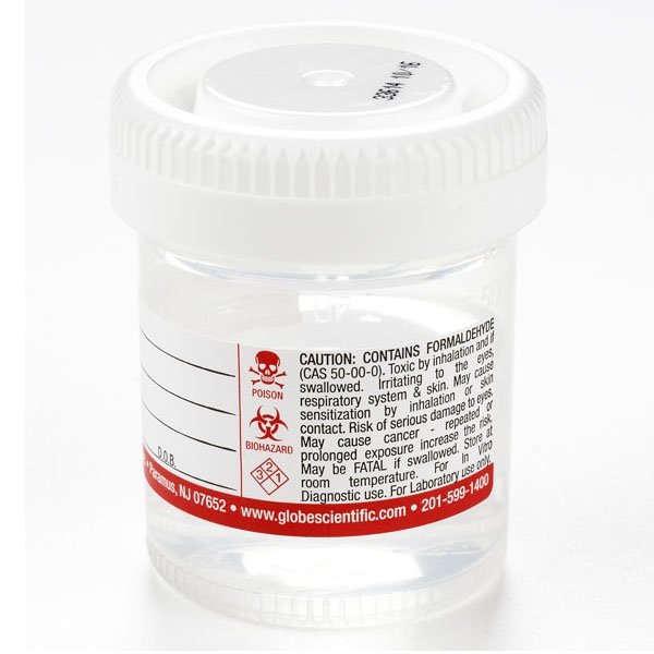 Tite-Rite Containers Prefilled with 10% Neutral Buffered Formalin Globe Scientific