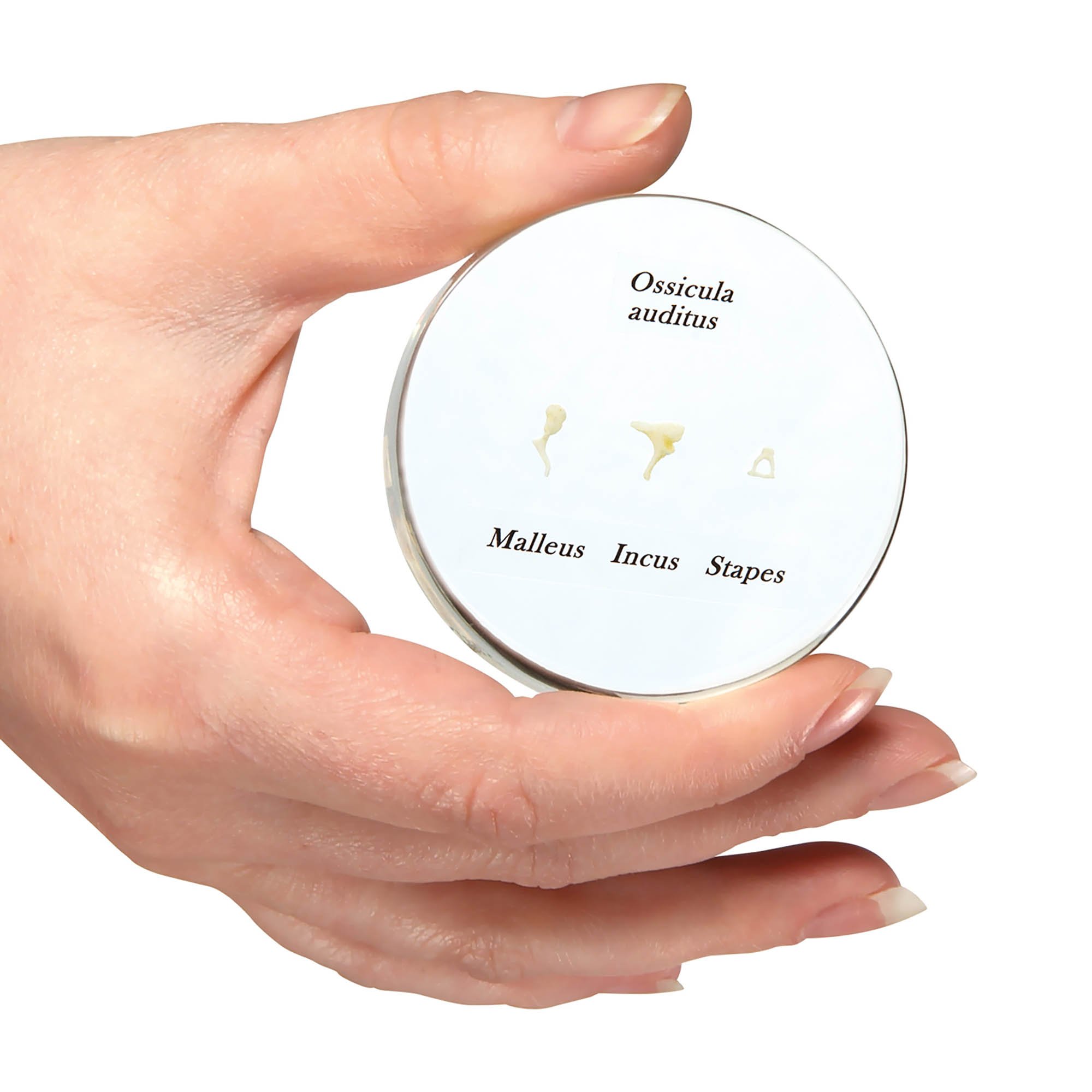 3B Scientific E13 Life Size Auditory Ossicles Embedded Model