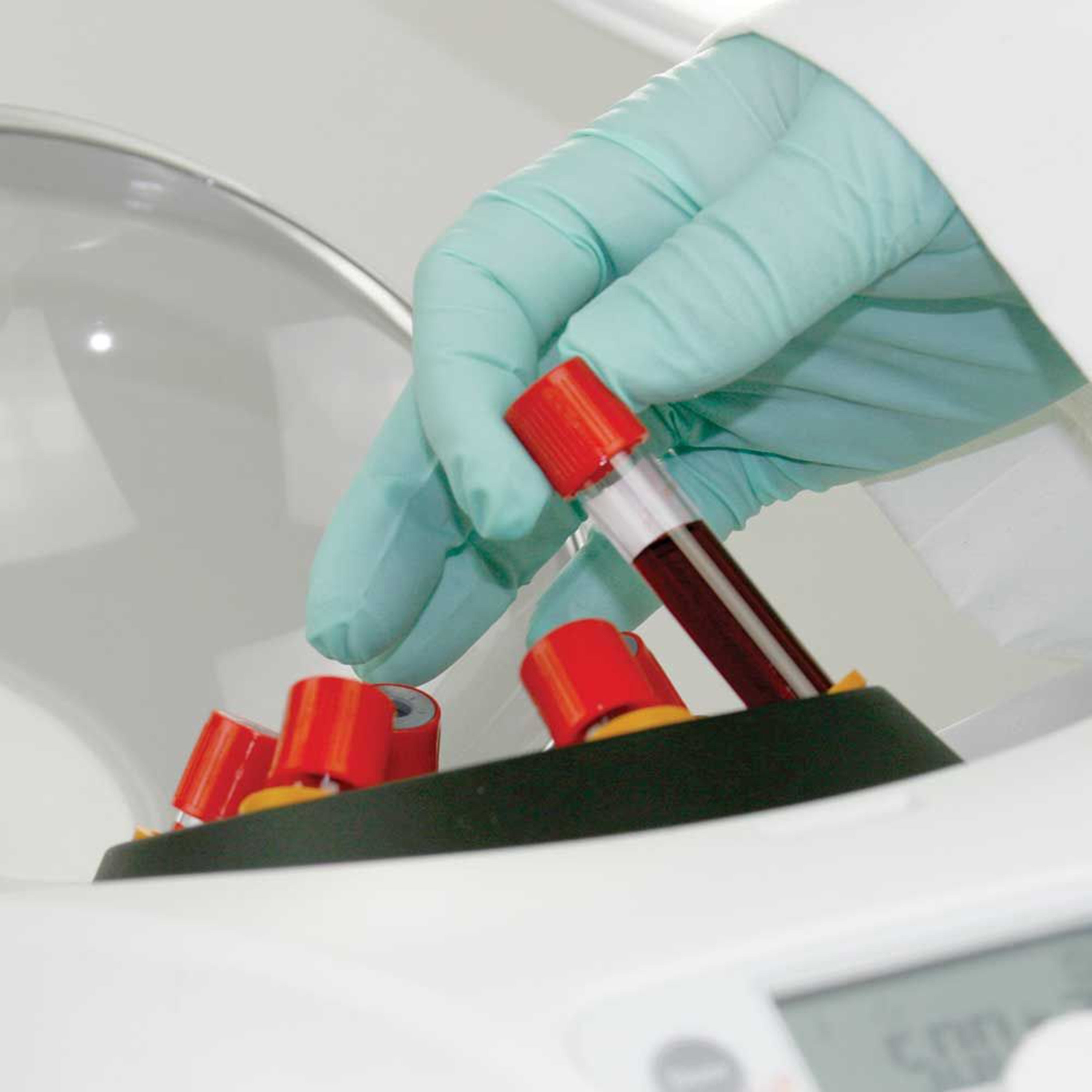 Globe Scientific GCC-P Portable Clinical Centrifuge