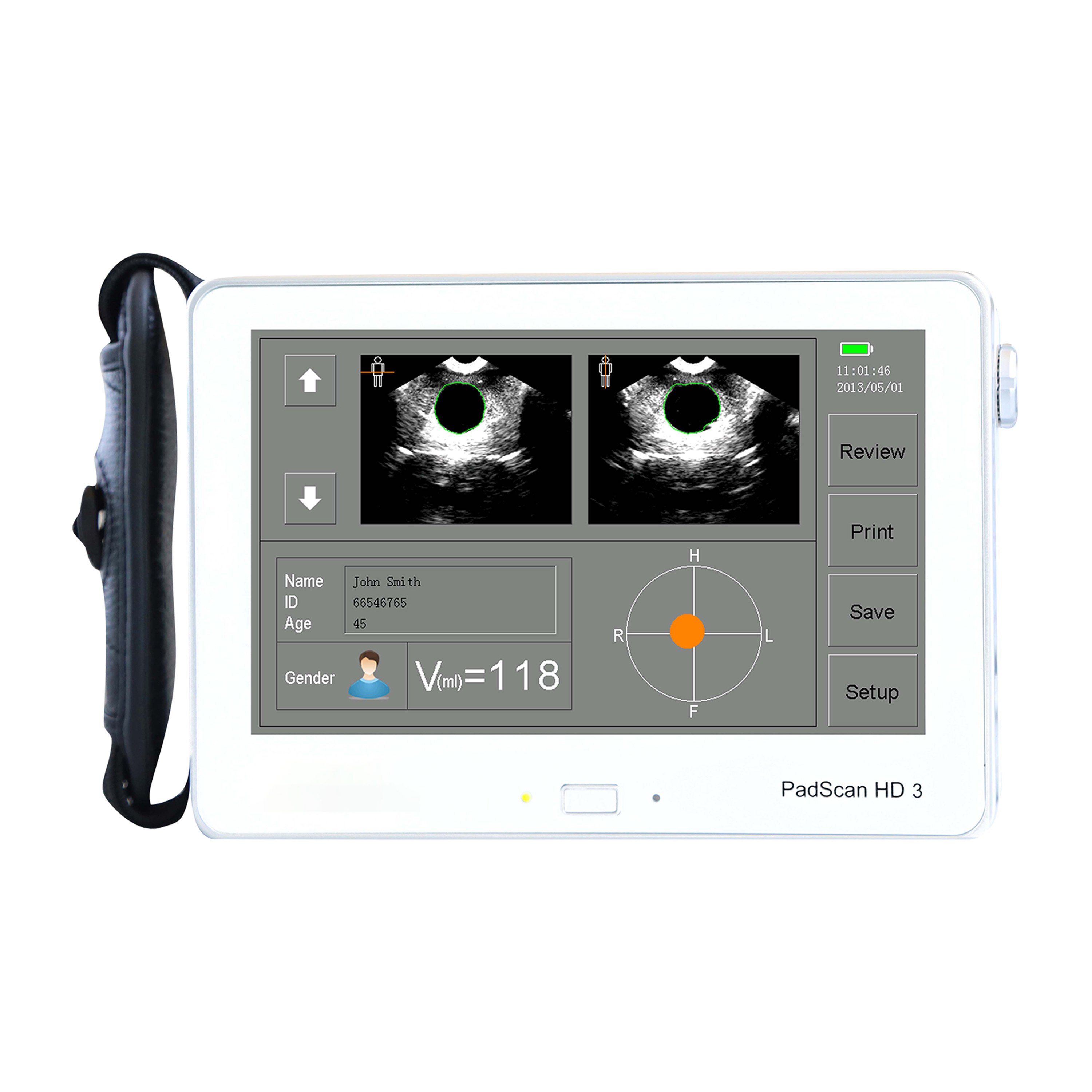 MDPro HD3 Bladder Scanner
