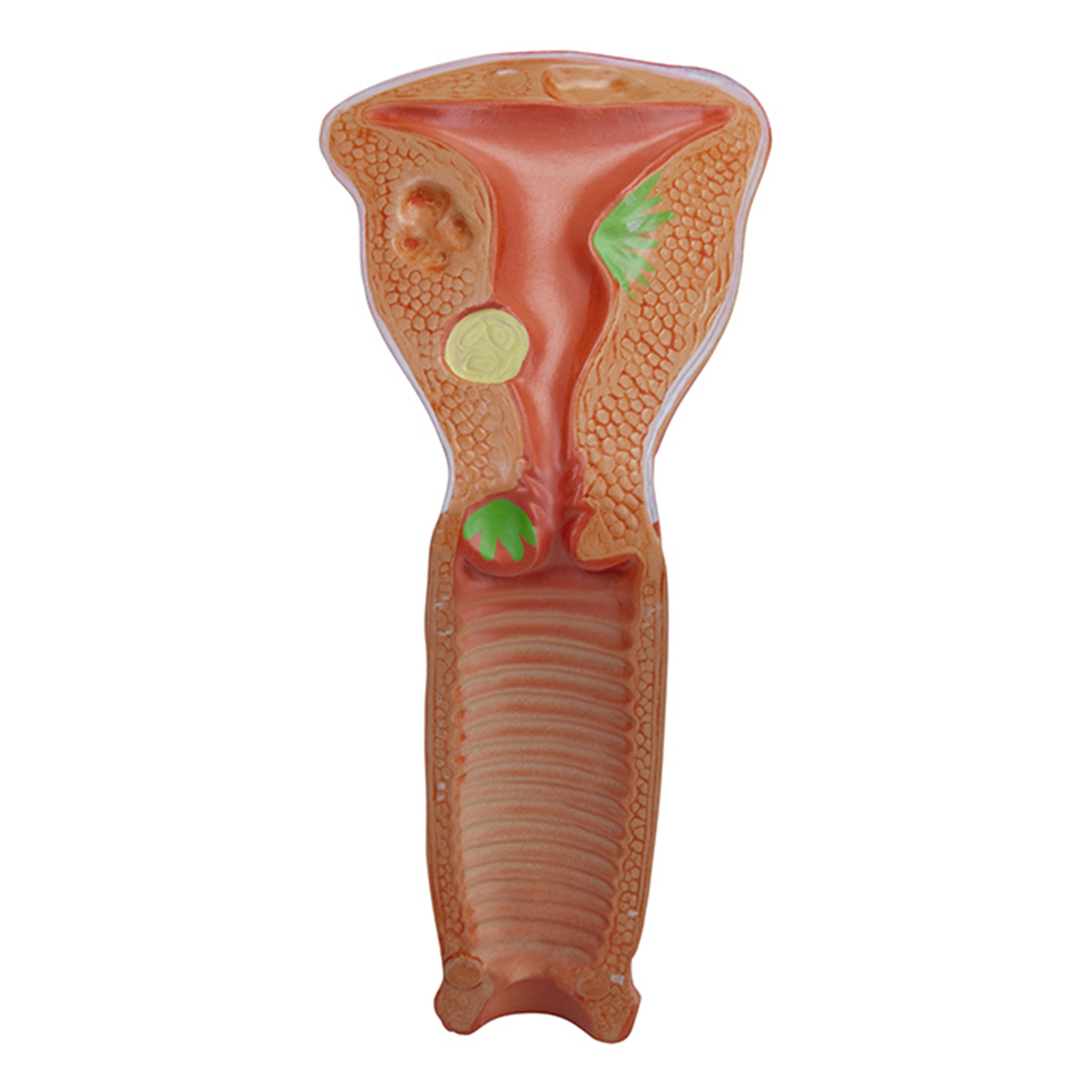 Nasco MG29947 Female Genital Organ with Pathology Model, 2 Parts