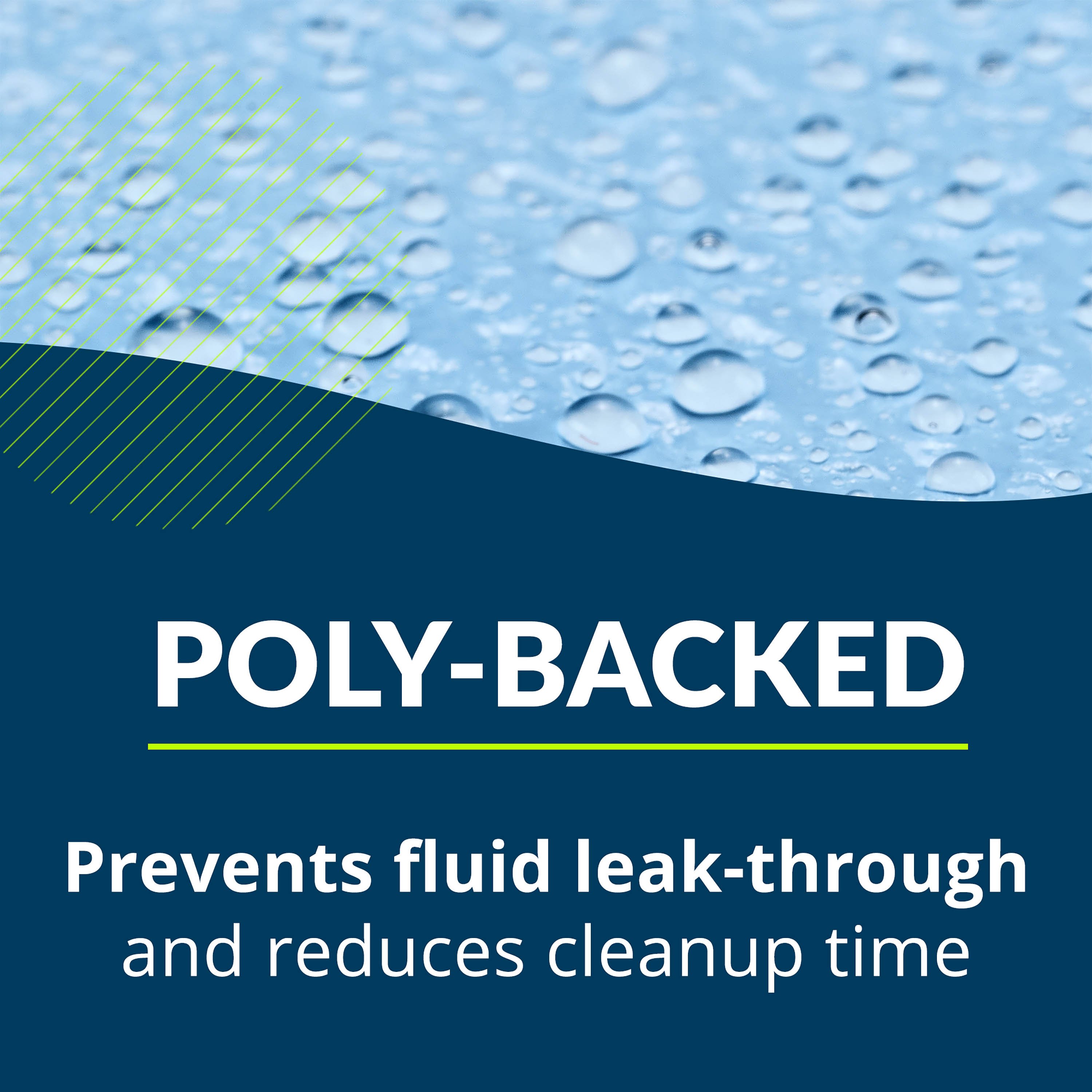 TIDI Products Choice Medical Towels 13" x 18"